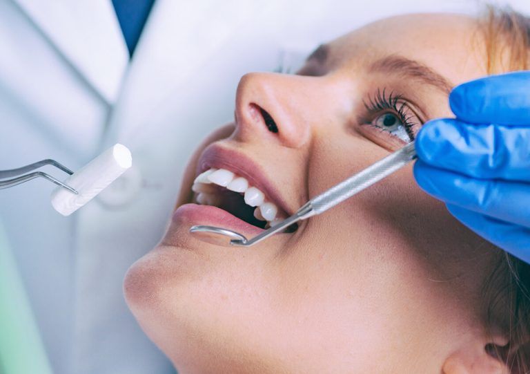 Composite Teeth Fillings – Aesthetic and Functional Benefits